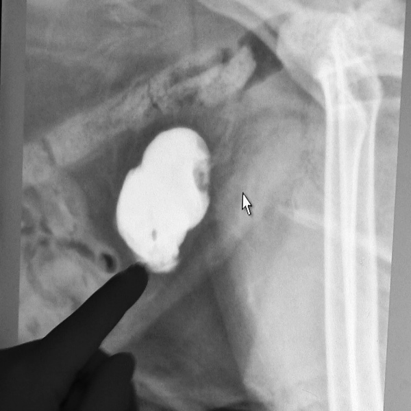 Contrast Cystography | atdove.org