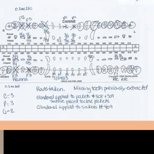 Getting Started with Dental Charting | atdove.org