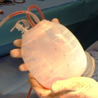 Jackson Pratt Drain Placement